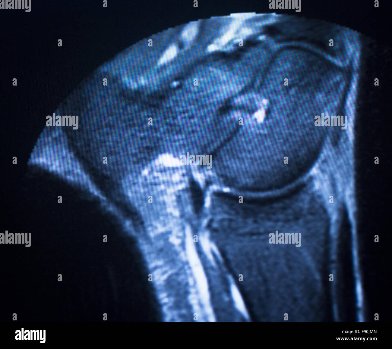Mri Magnetic Resonance Imaging Medical Scan Test Results Showing