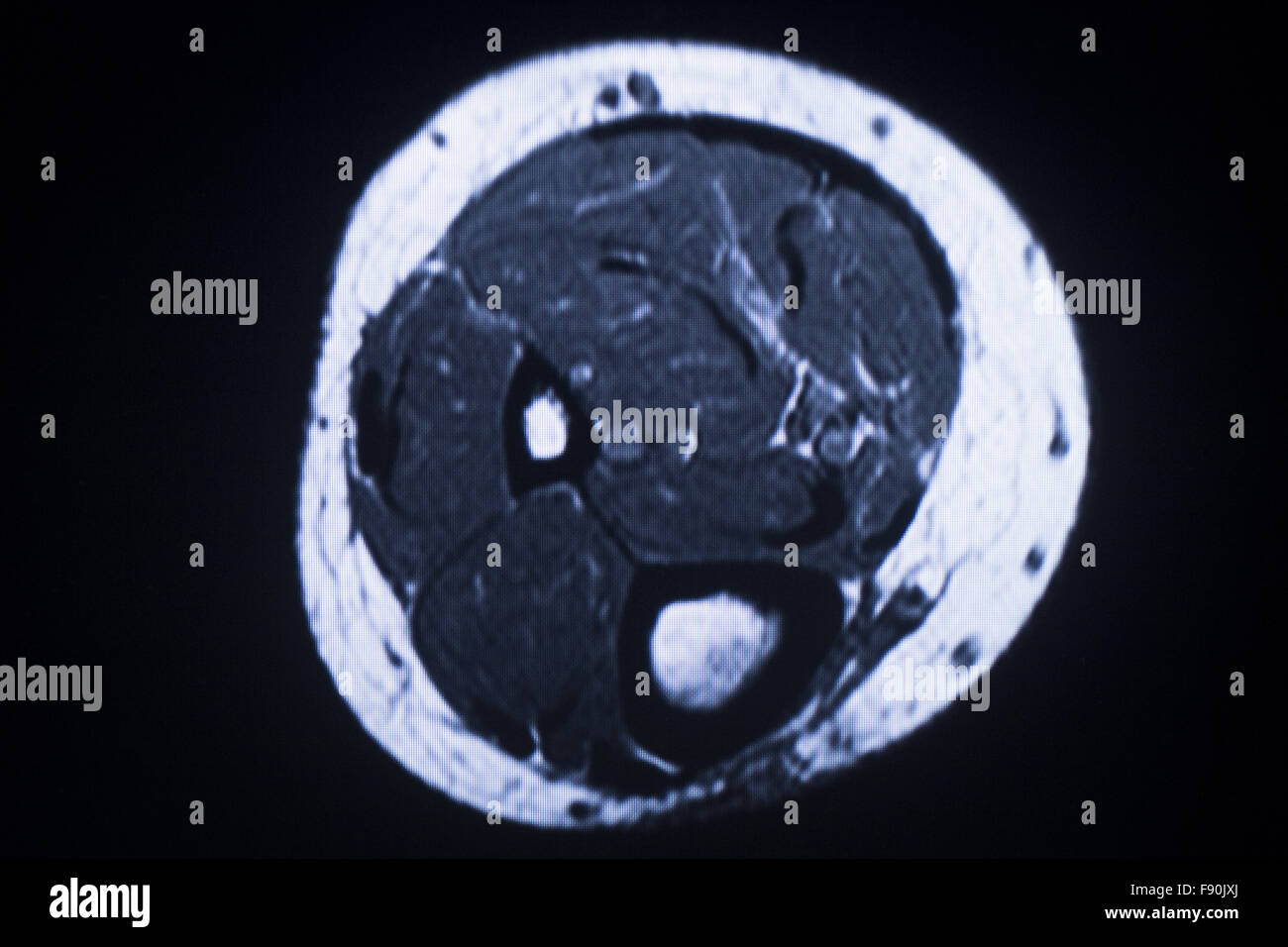 MRI magnetic resonance imaging medical scan test results showing ...