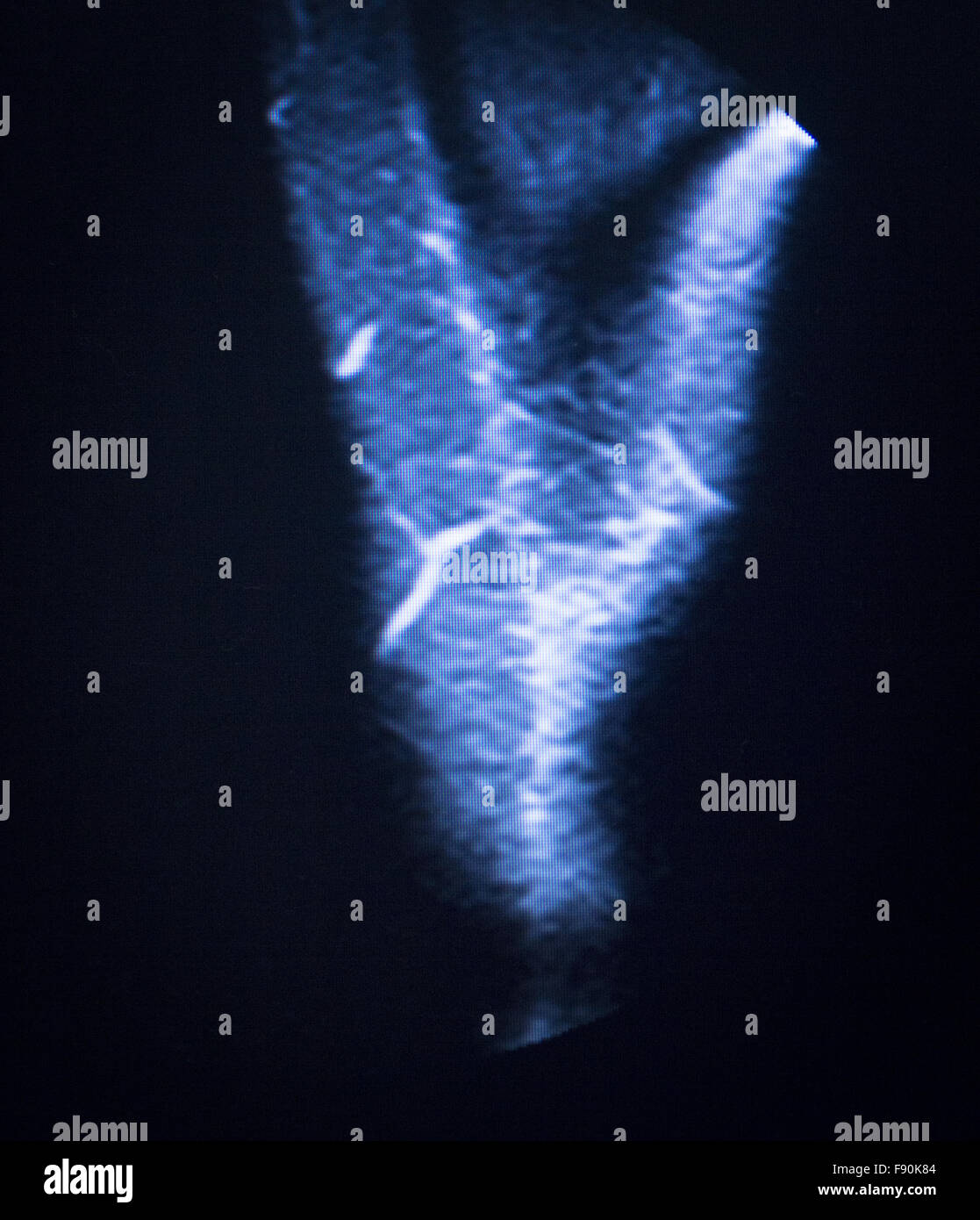 MRI magnetic resonance imaging medical scan test results showing ...