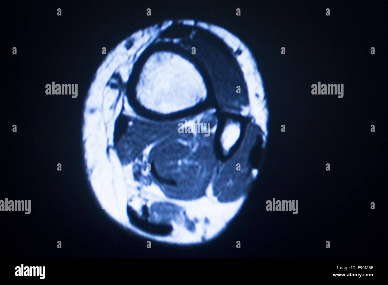 MRI magnetic resonance imaging medical scan test results showing ...
