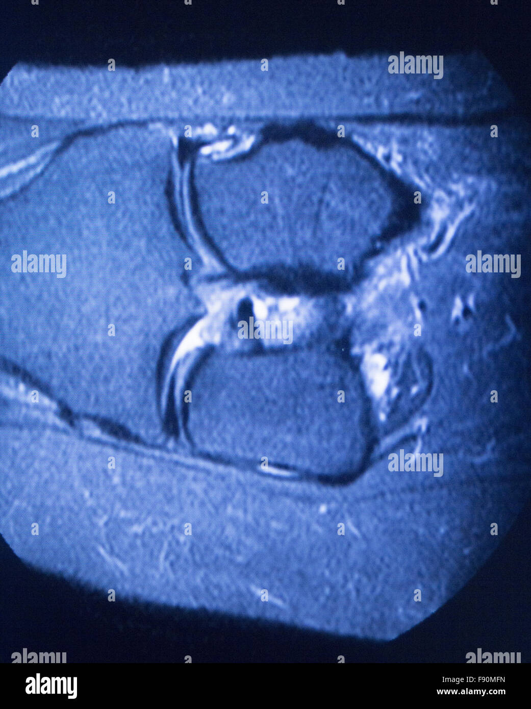 MRI magnetic resonance imaging medical scan test results showing ...