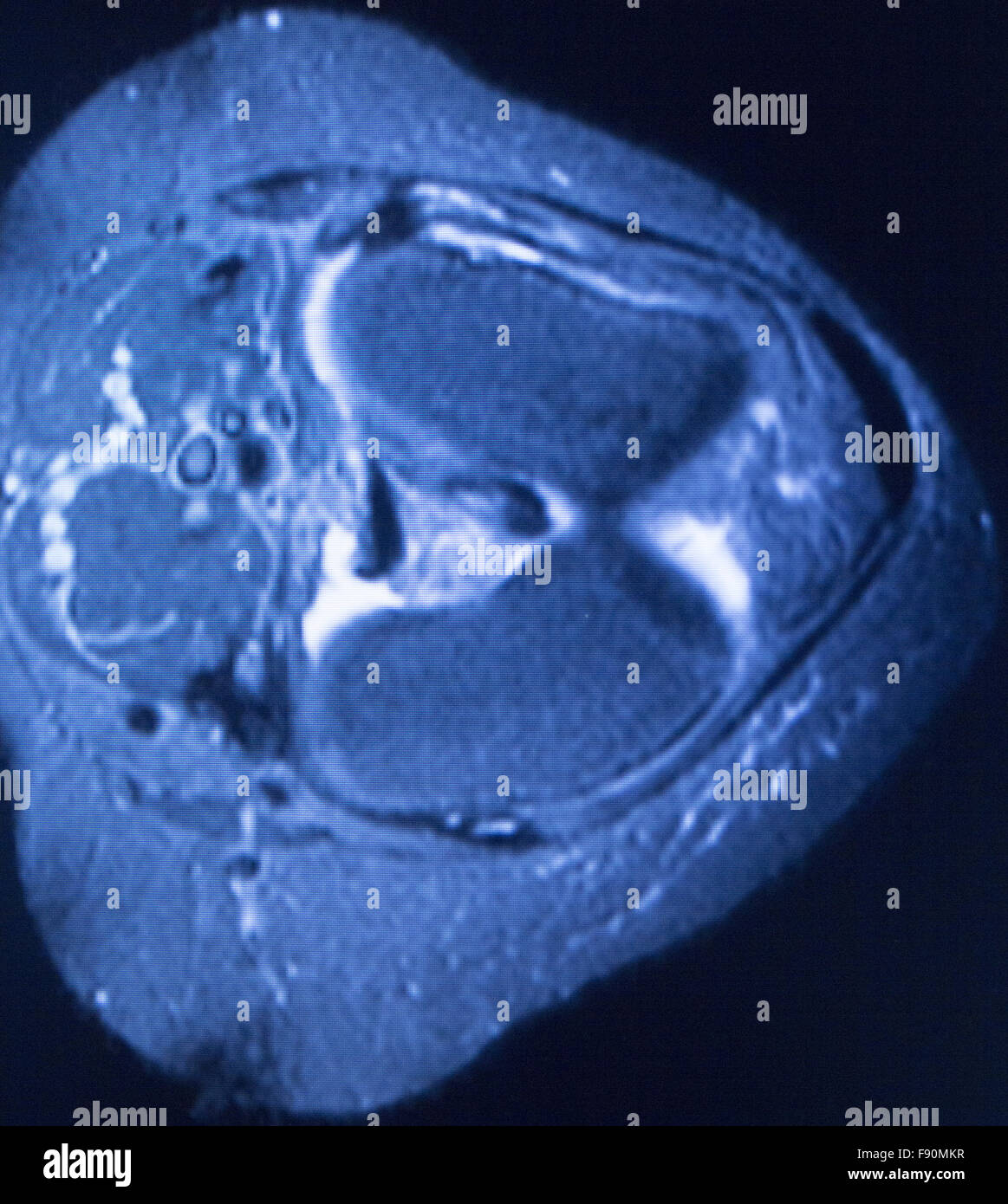 MRI magnetic resonance imaging medical scan test results showing ...
