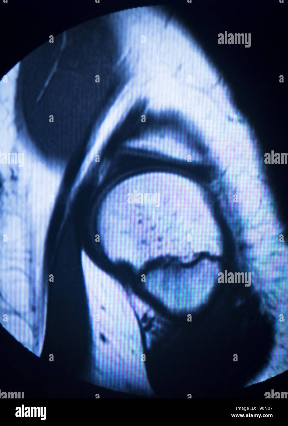 MRI magnetic resonance imaging medical scan test results showing knee ...