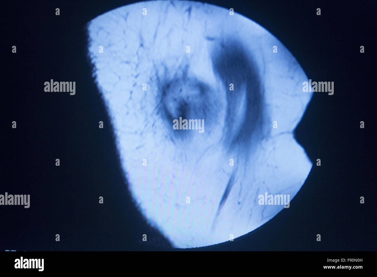 MRI magnetic resonance imaging medical scan test results showing knee ...
