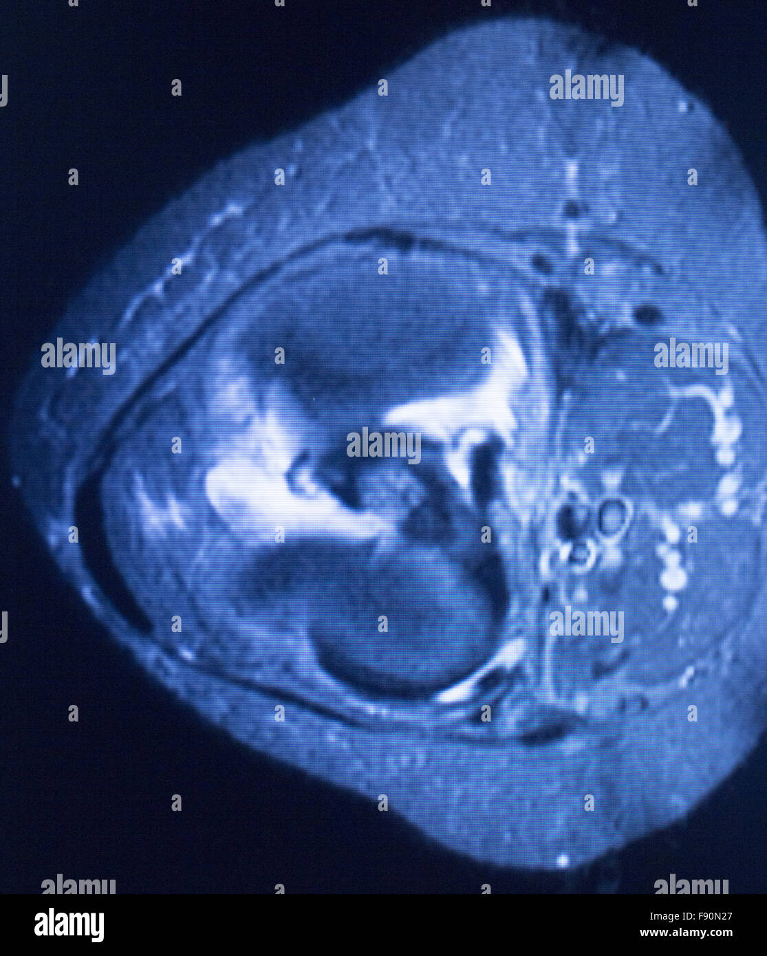 MRI magnetic resonance imaging medical scan test results showing ...