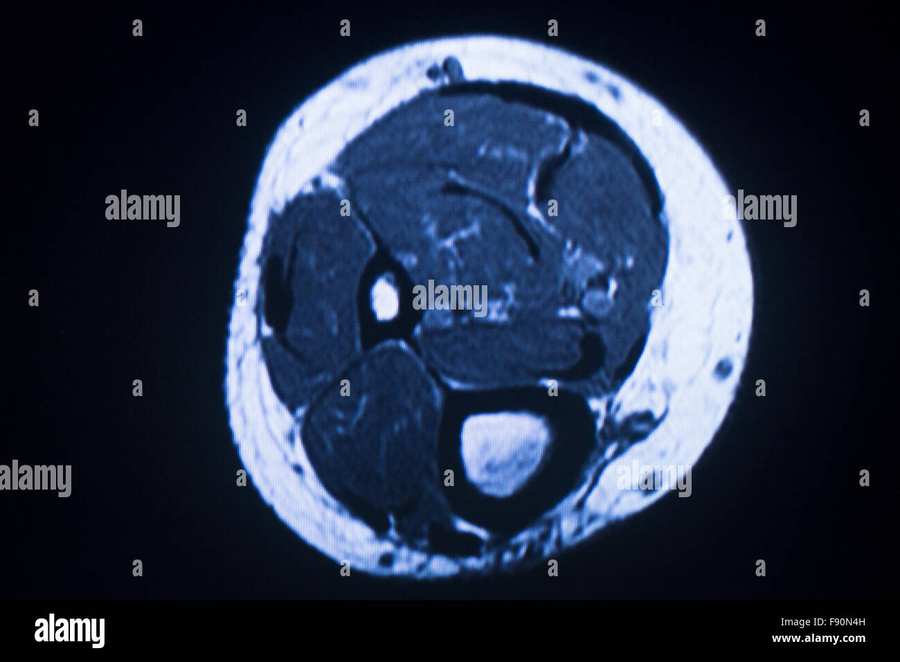 MRI magnetic resonance imaging medical scan test results showing ...