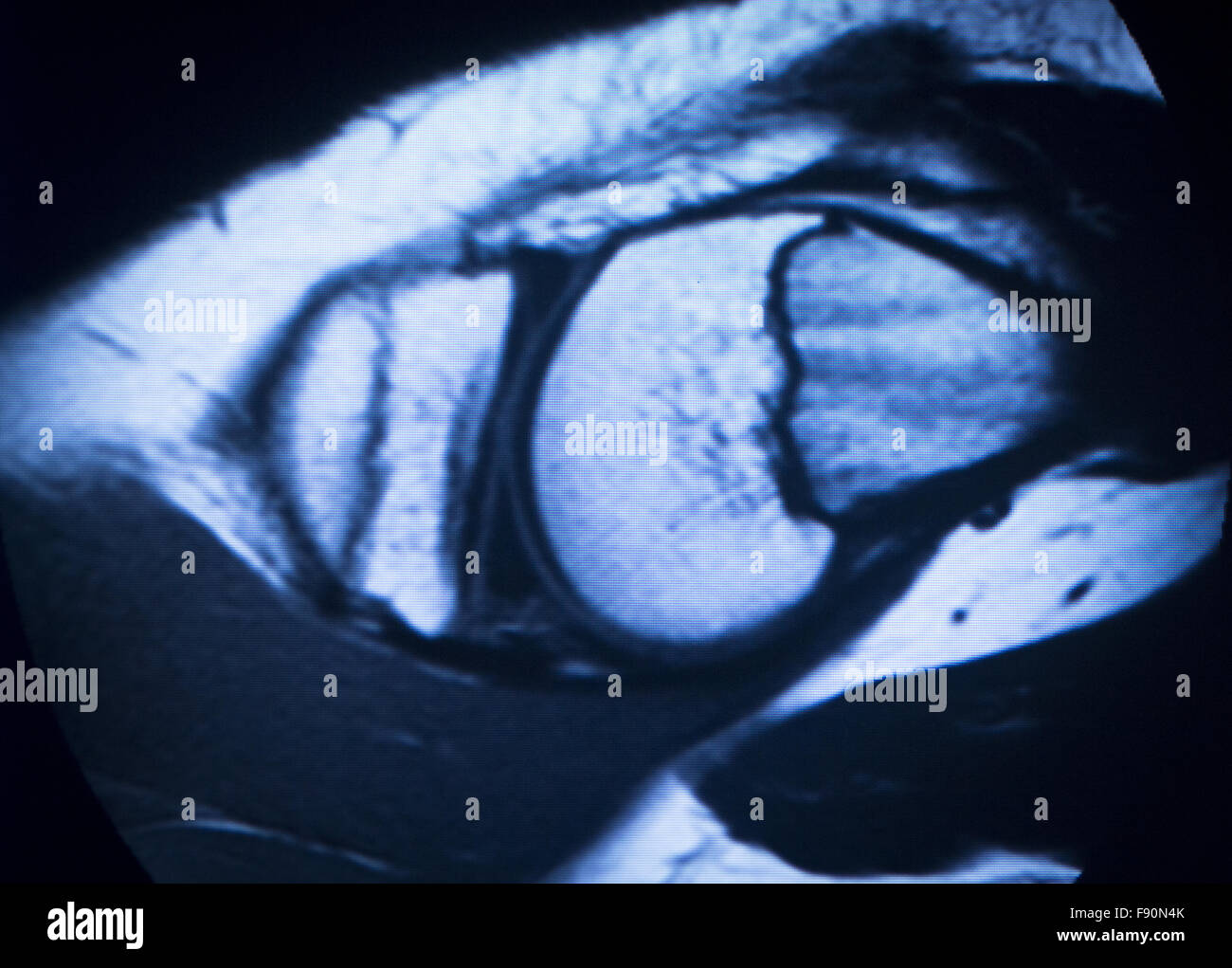 MRI magnetic resonance imaging medical scan test results showing knee ...