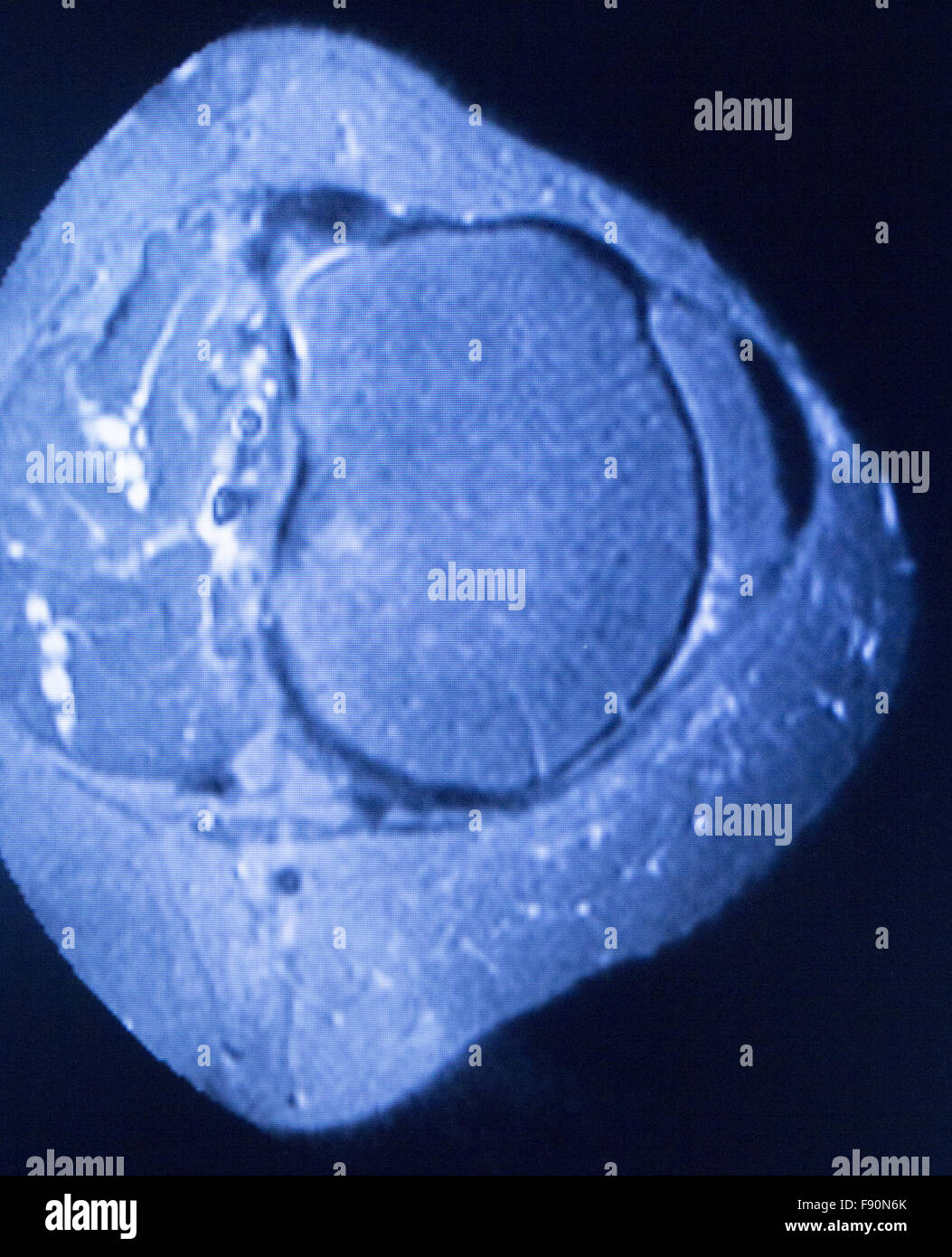 MRI magnetic resonance imaging medical scan test results showing ...