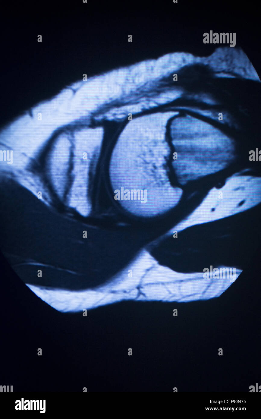 Mri Scanning Knee And Leg High Resolution Stock Photography and Images ...