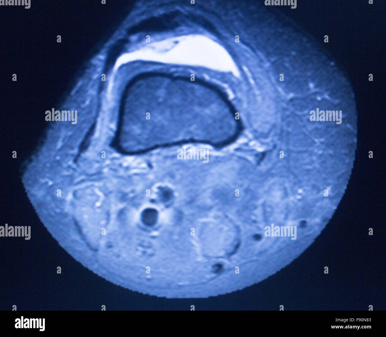 MRI magnetic resonance imaging medical scan test results showing ...