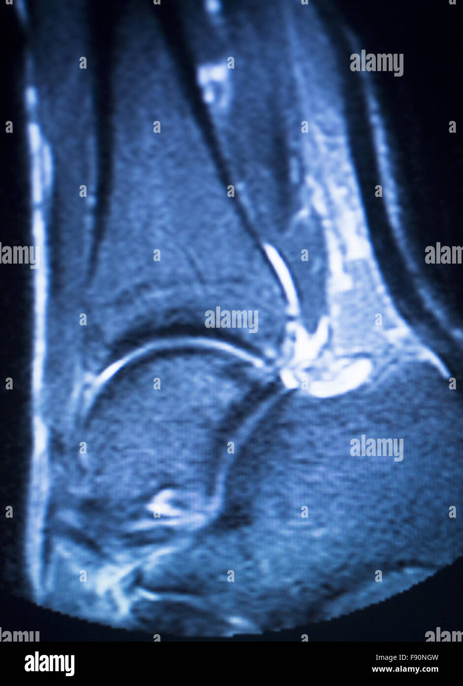 MRI magnetic resonance imaging medical scan test results showing ...