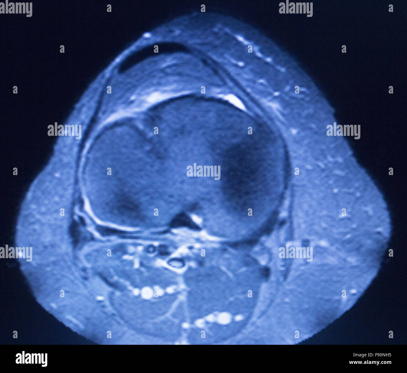 MRI magnetic resonance imaging medical scan test results showing ...