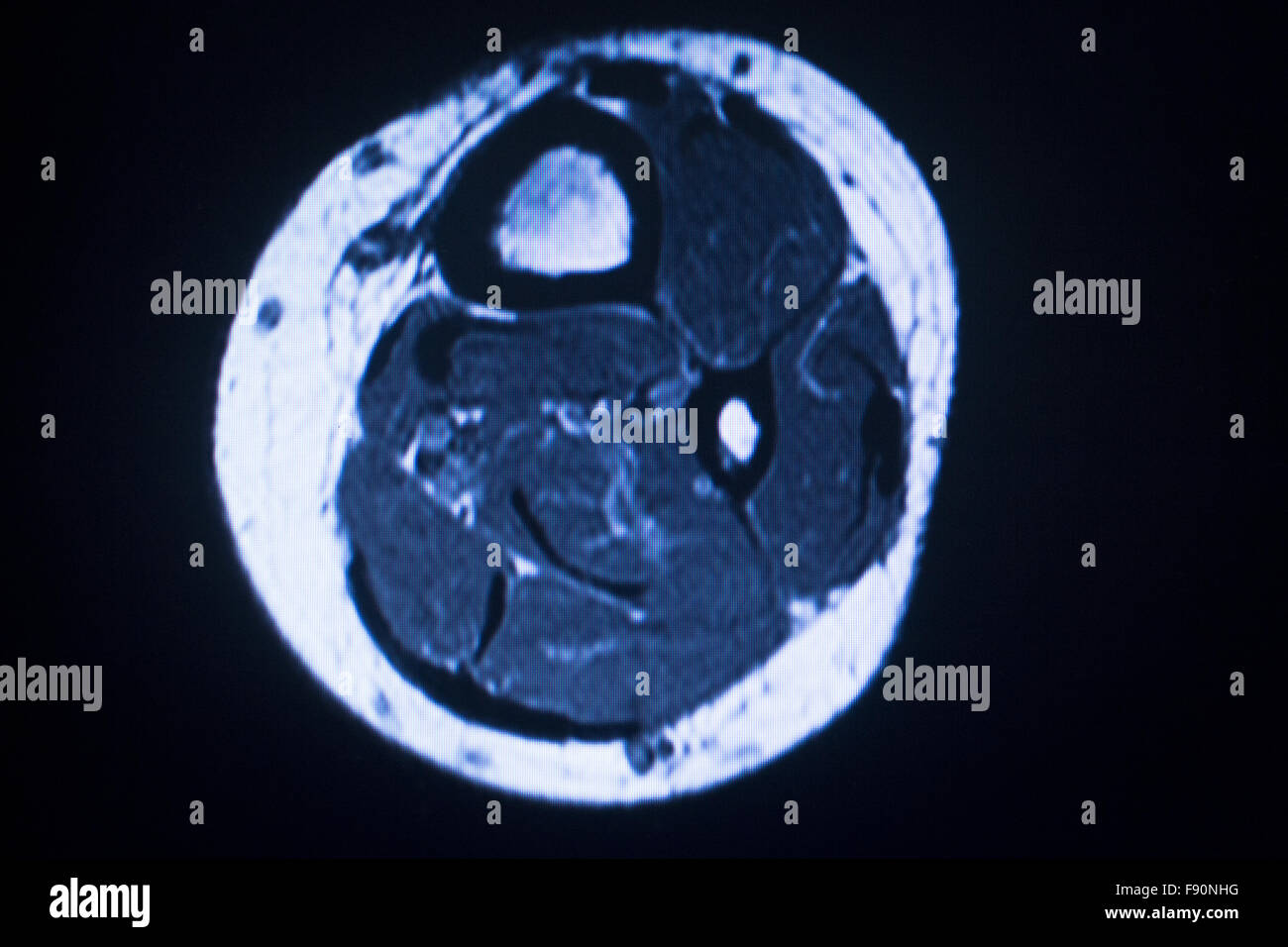MRI magnetic resonance imaging medical scan test results showing ...