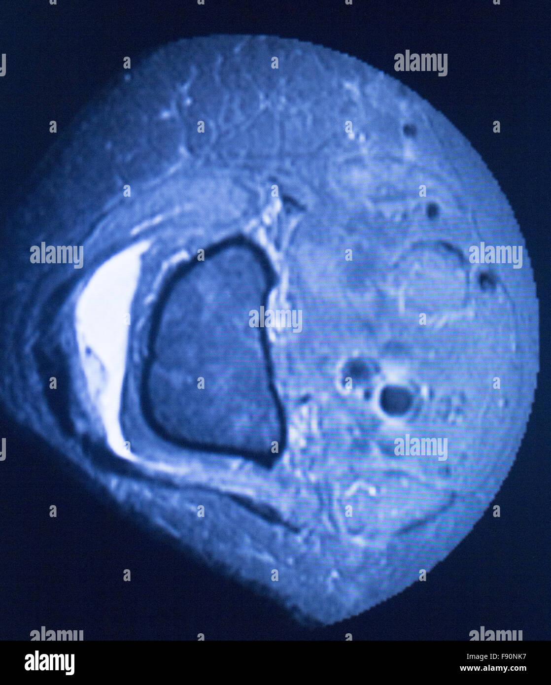 MRI magnetic resonance imaging medical scan test results showing ...