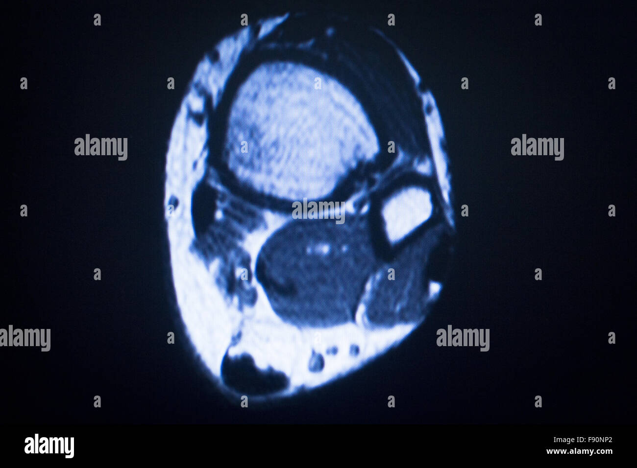 MRI magnetic resonance imaging medical scan test results showing ...