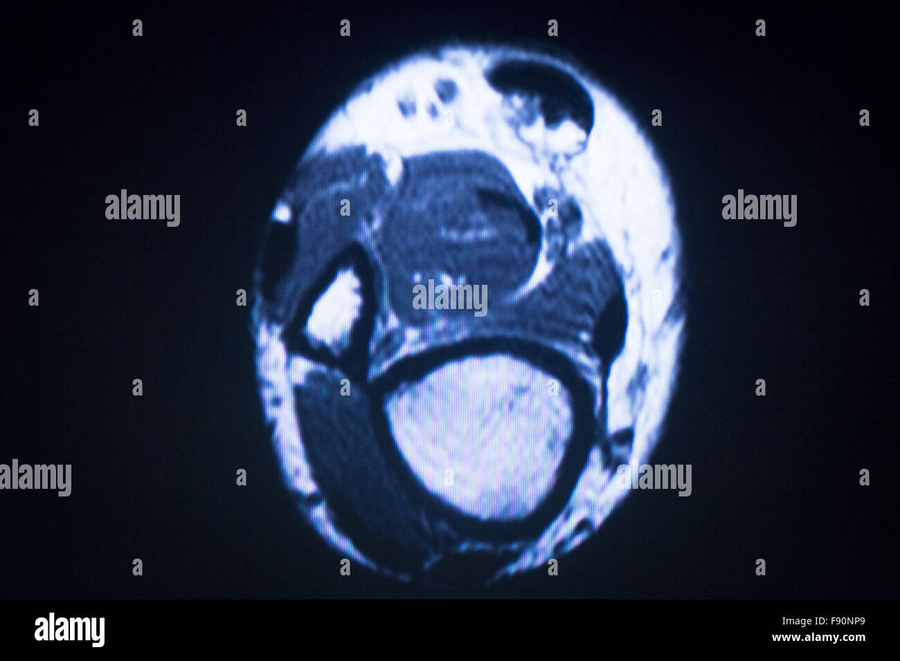 MRI magnetic resonance imaging medical scan test results showing ...
