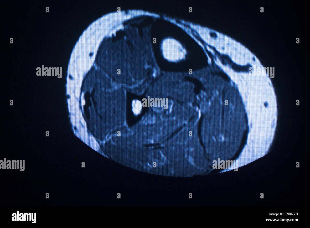 MRI magnetic resonance imaging medical scan test results showing ...