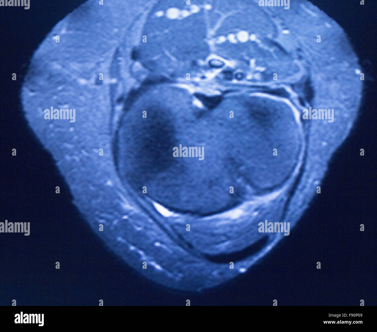 MRI magnetic resonance imaging medical scan test results showing ...