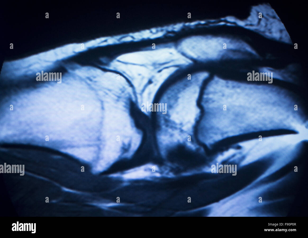 MRI magnetic resonance imaging medical scan test results showing knee ...