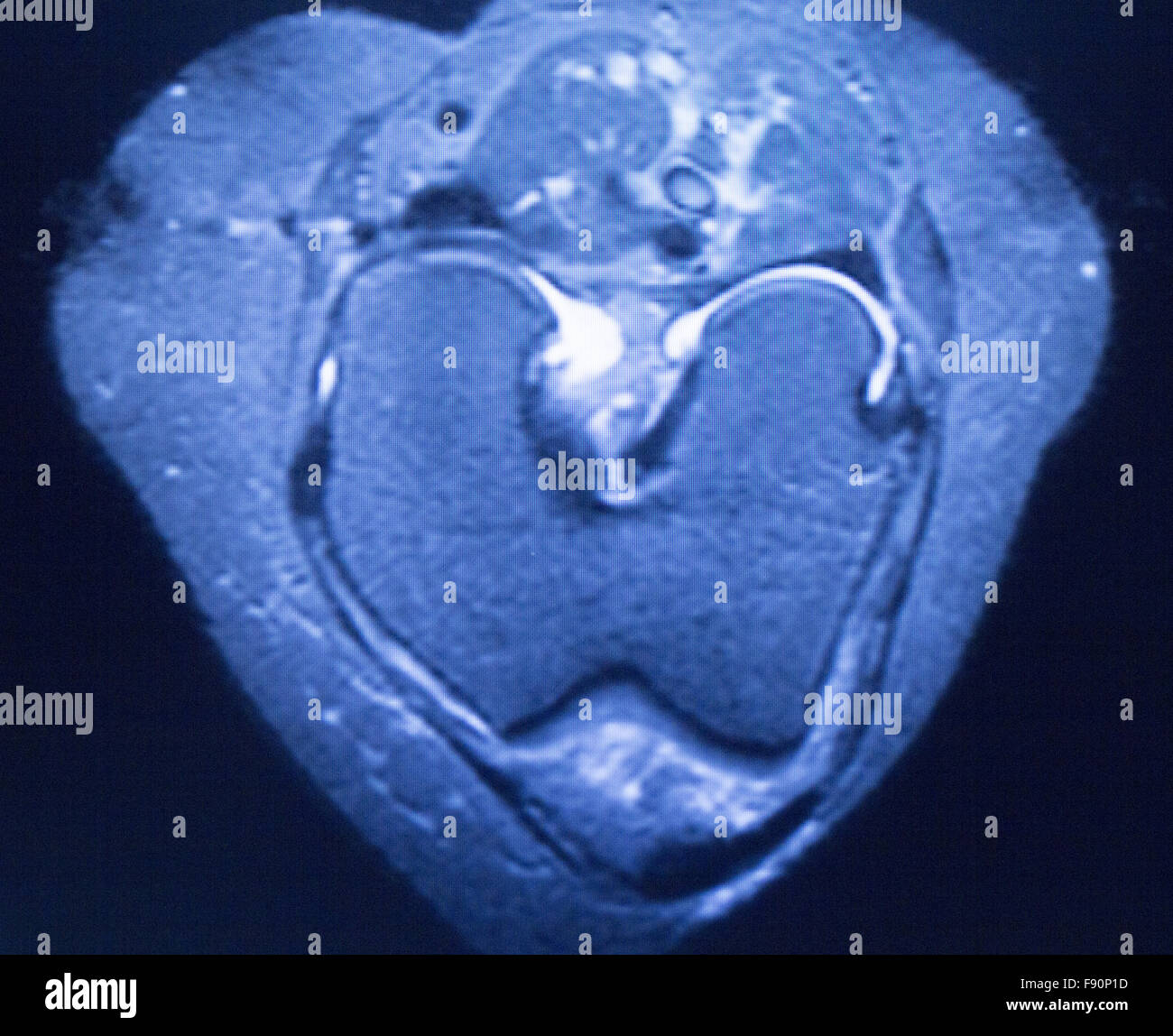 MRI magnetic resonance imaging medical scan test results showing ...