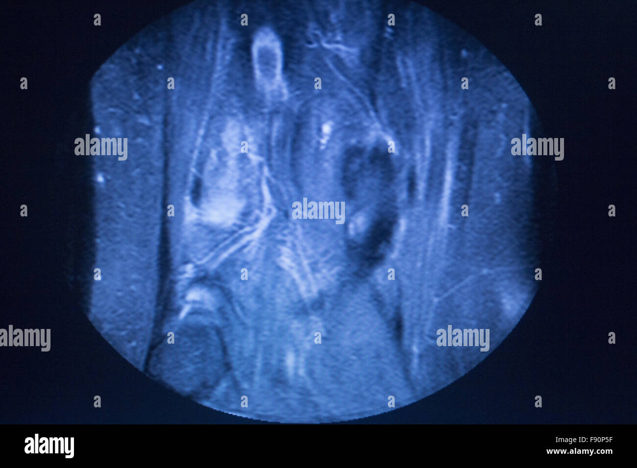 MRI magnetic resonance imaging medical scan test results showing ...