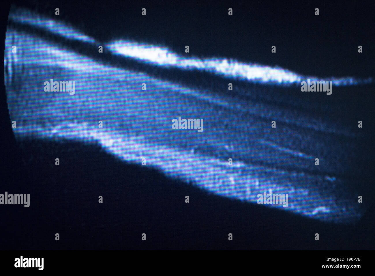 MRI magnetic resonance imaging medical scan test results showing ...