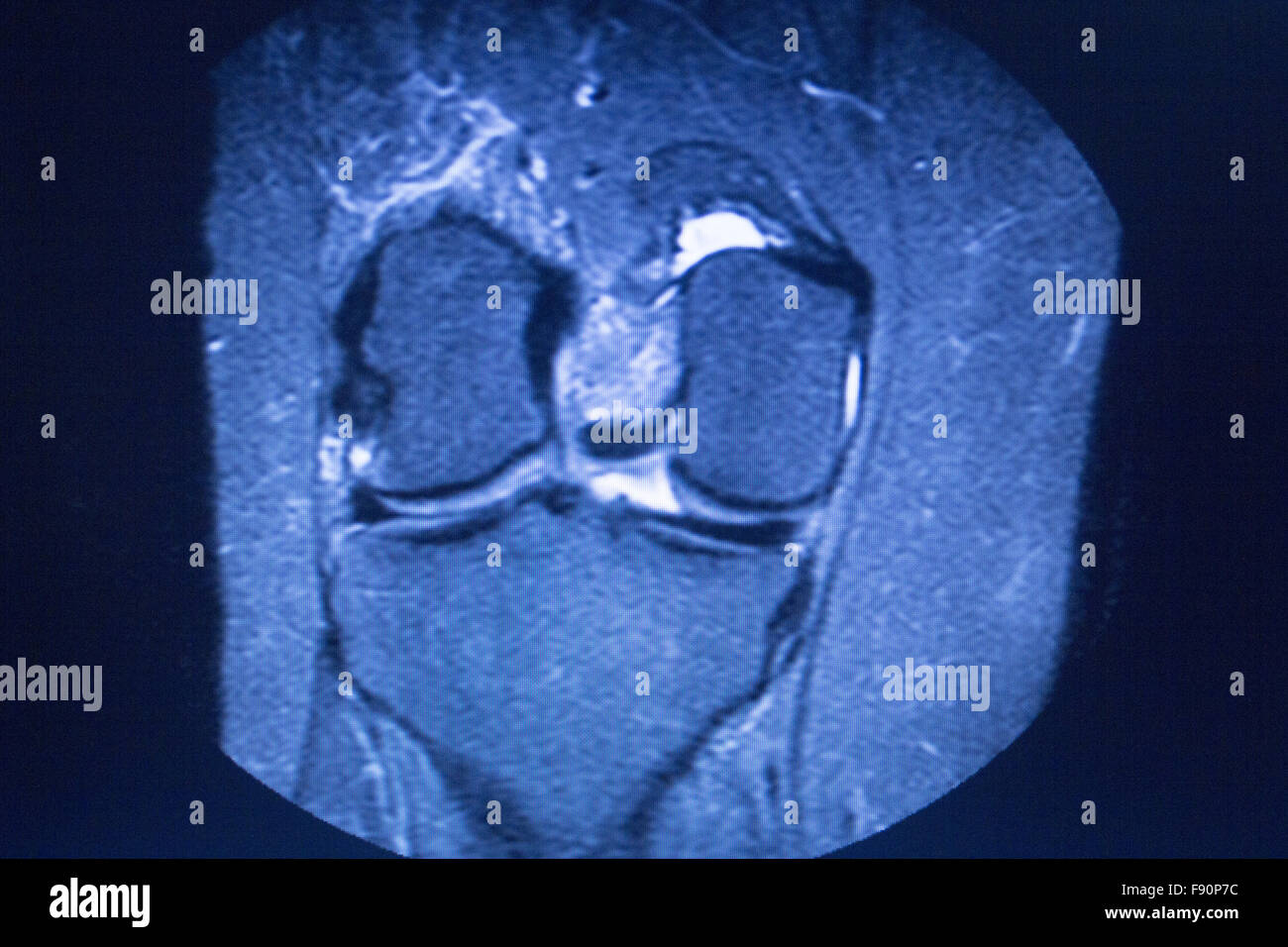 MRI magnetic resonance imaging medical scan test results showing ...