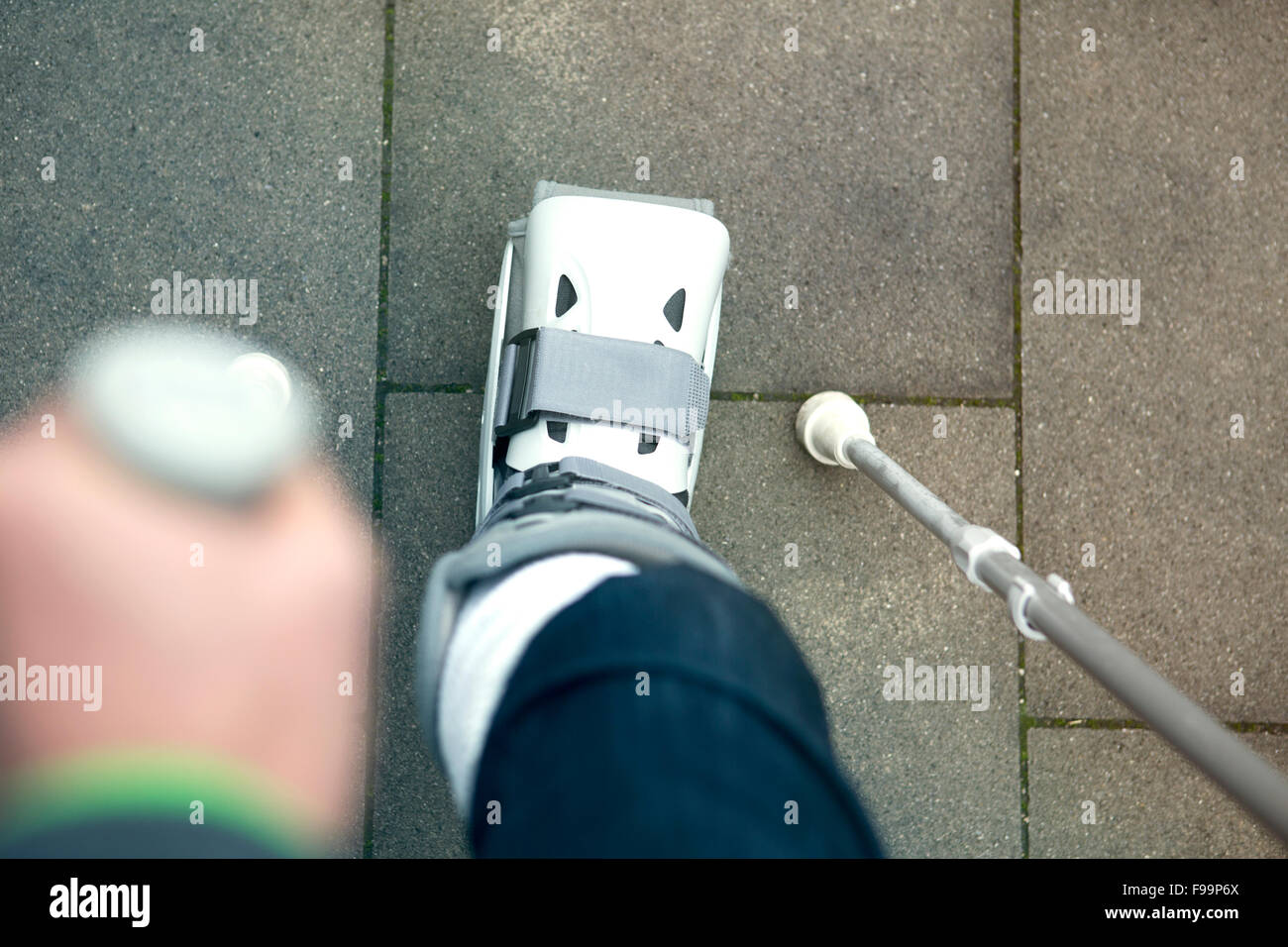 closeup of person walking with a plaster cast and crutches Stock Photo ...