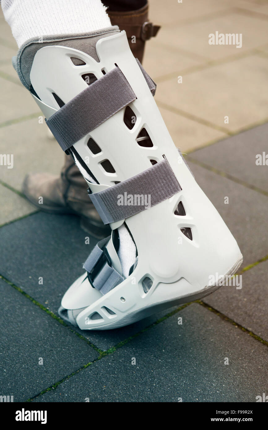 closeup of woman walking with a plaster cast Stock Photo - Alamy