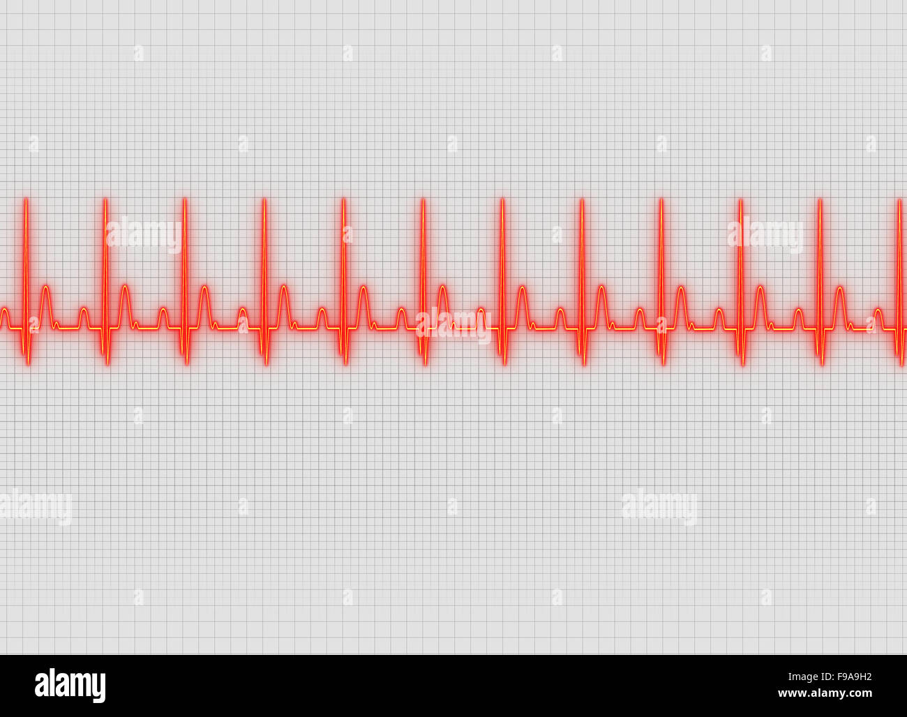 a electrocardiography illustration in light screen background Stock ...