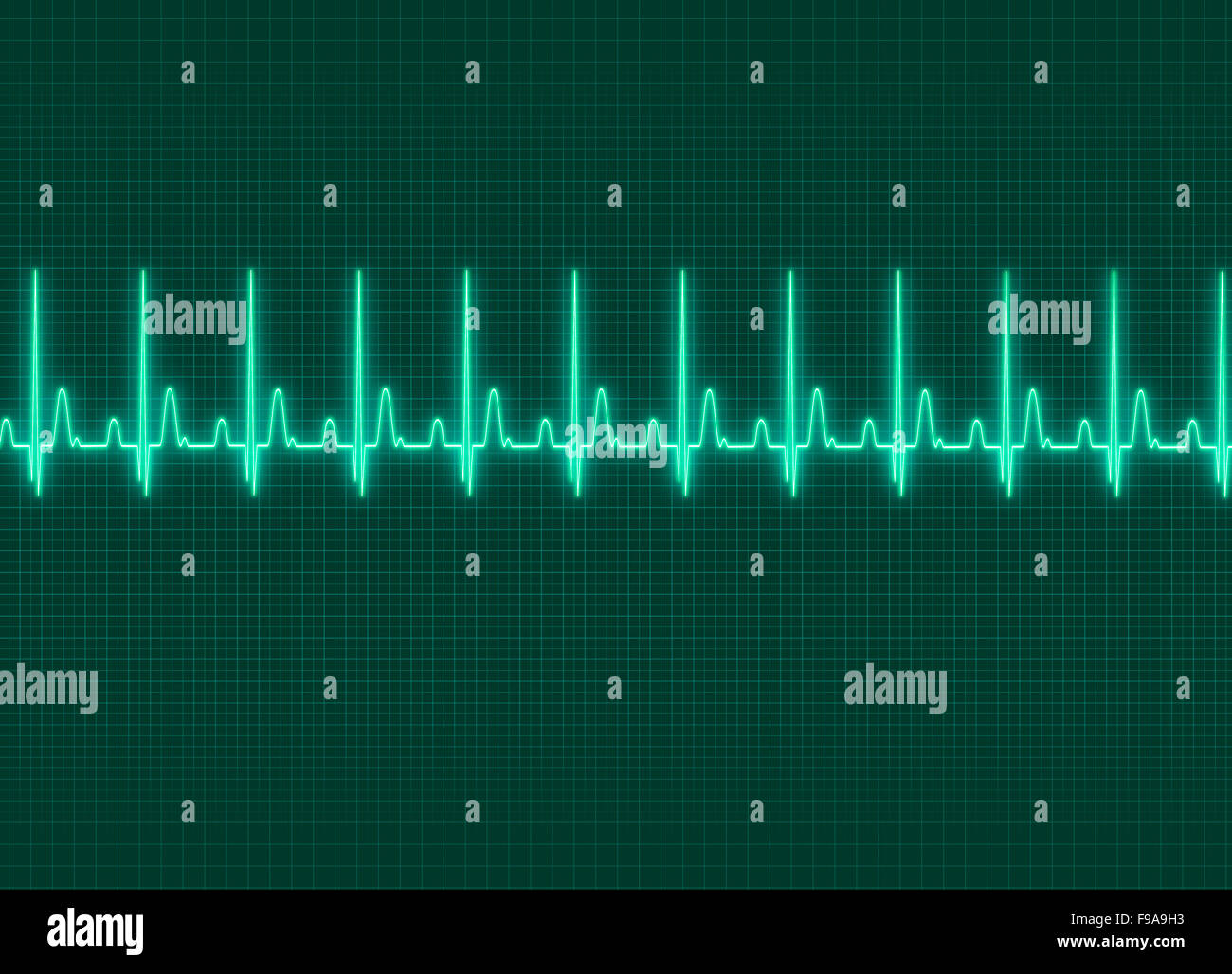 a electrocardiography illustration in dark screen background Stock ...