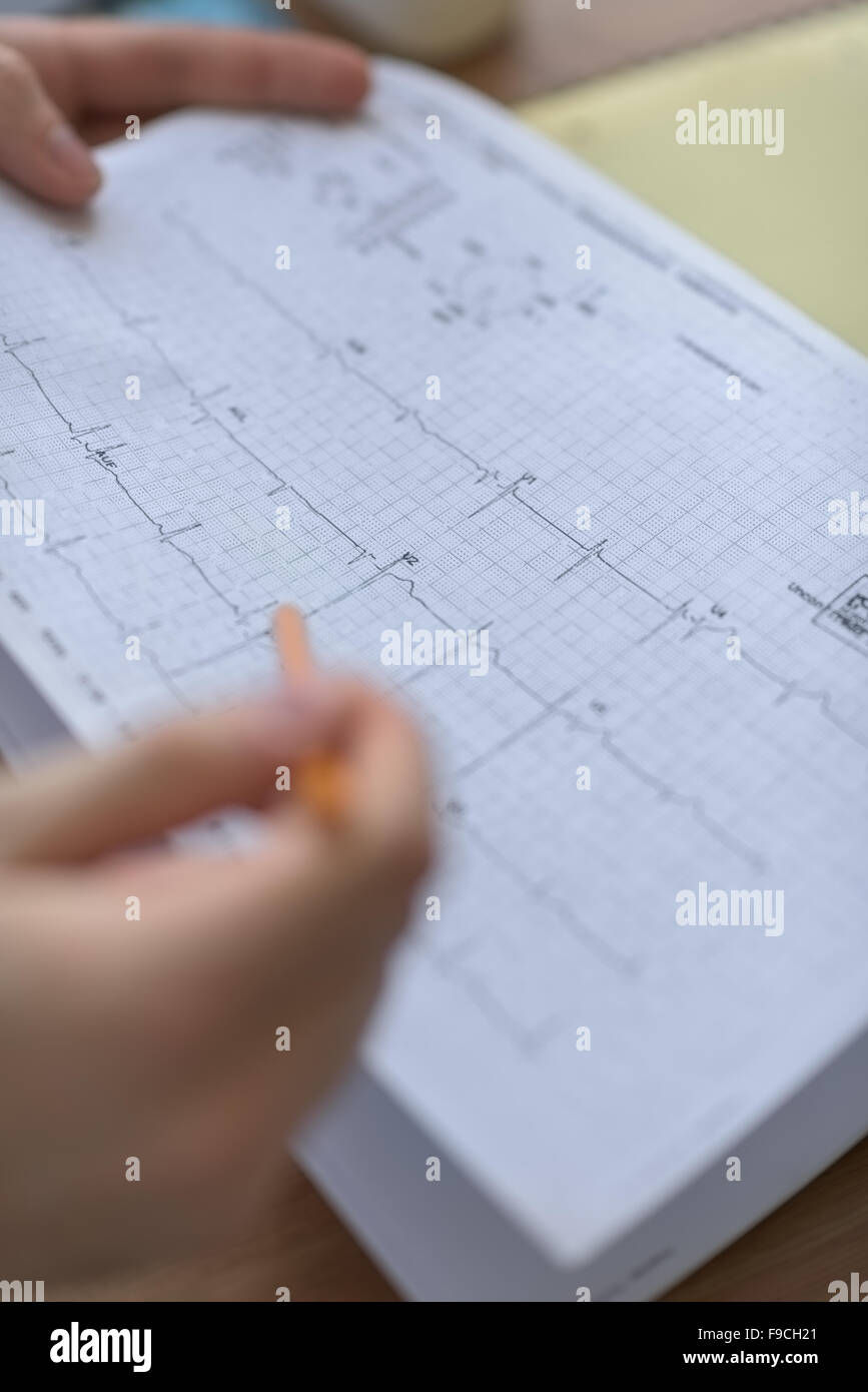 Doctor reading ecg hi-res stock photography and images - Alamy