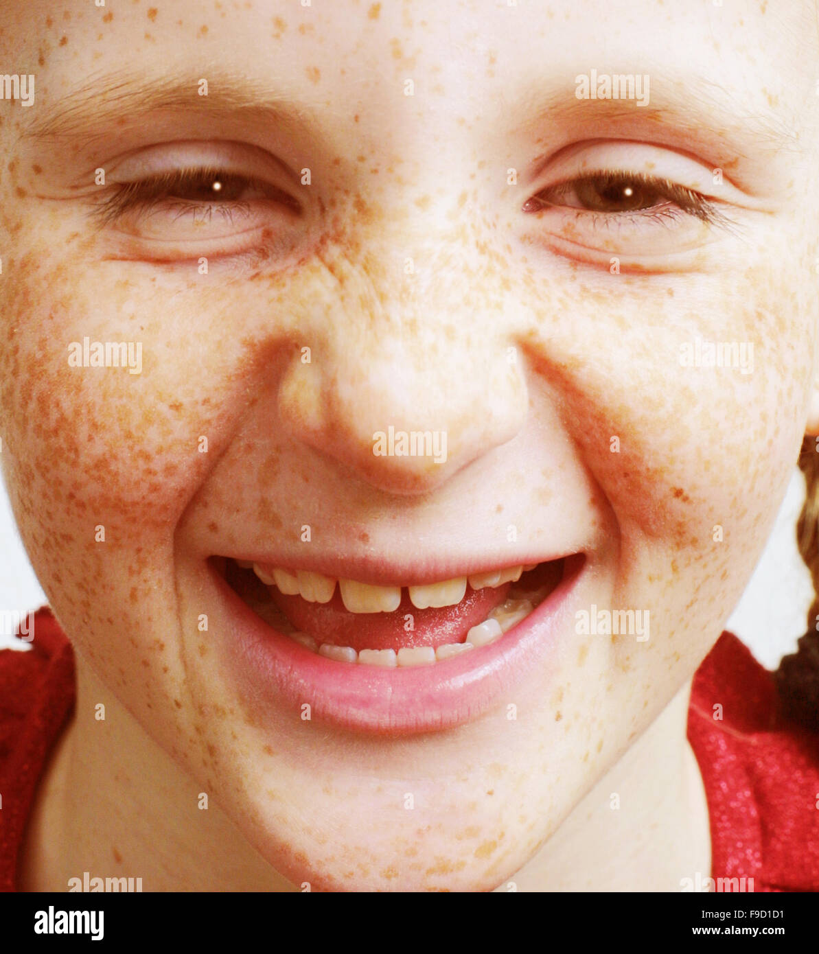 Freckled faces hi-res stock photography and images - Alamy