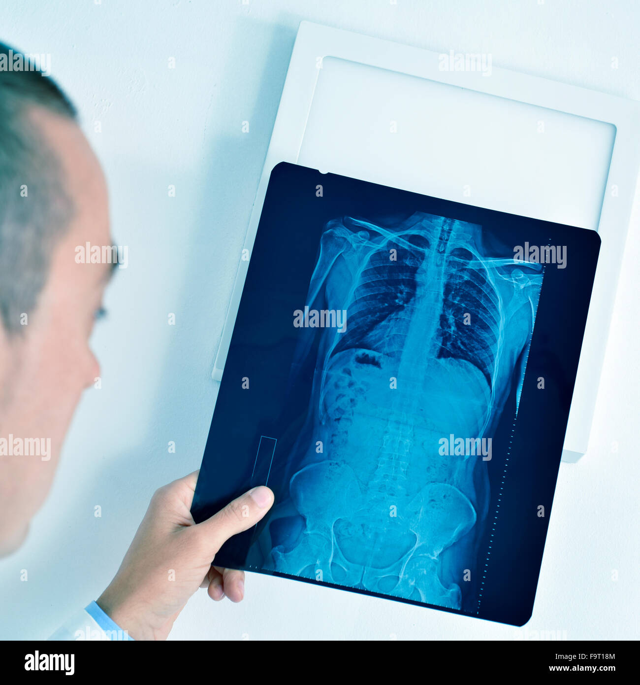 Thoracic skeleton hi-res stock photography and images - Alamy