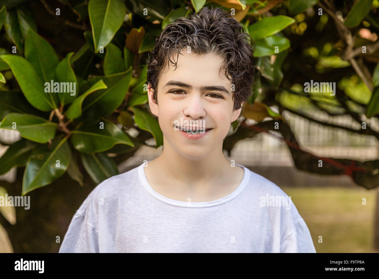 teenager with acne skin smiling while showing braces with green ...