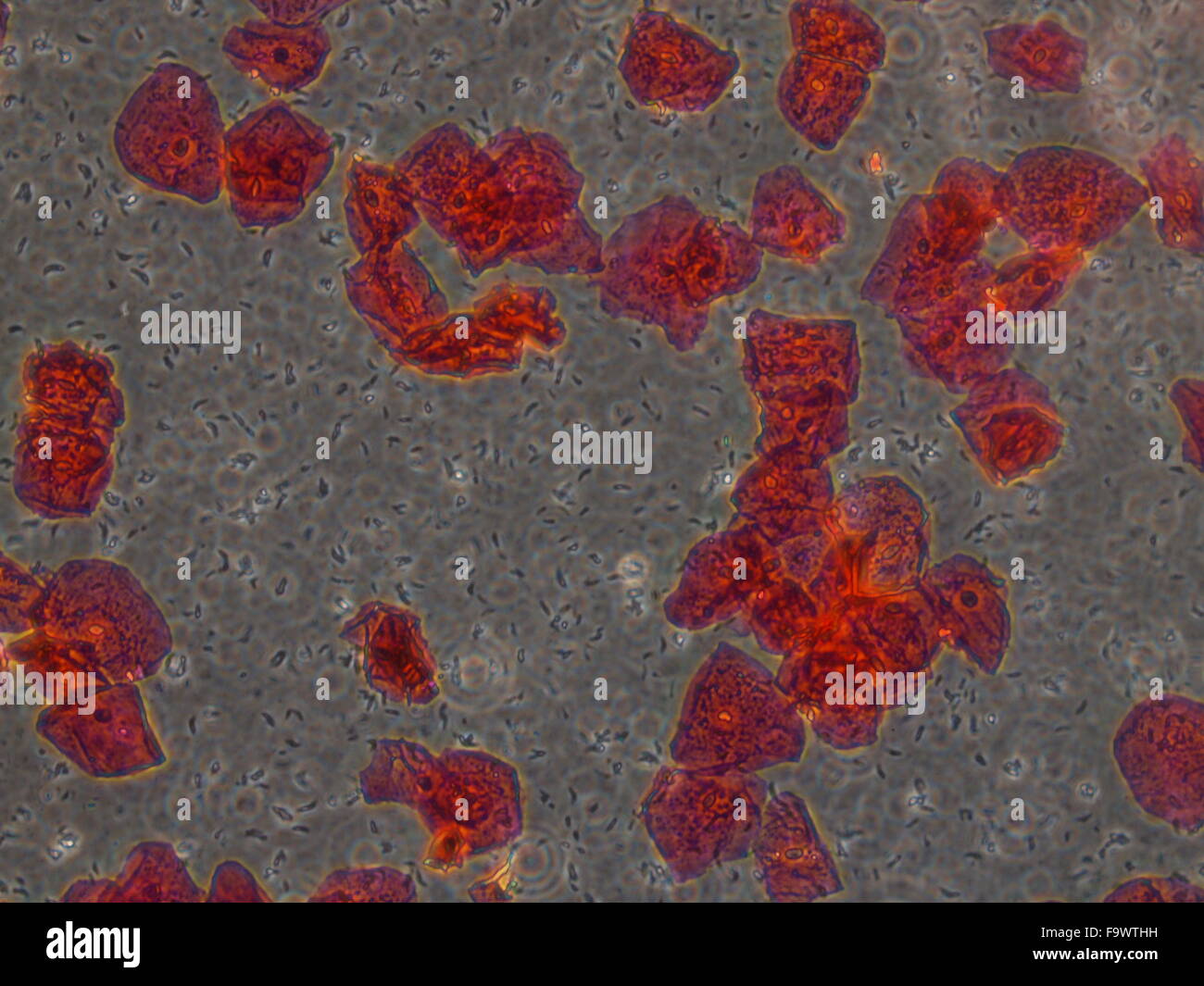 Biological sample cells and bacteria, plant, microb under microscopy ...