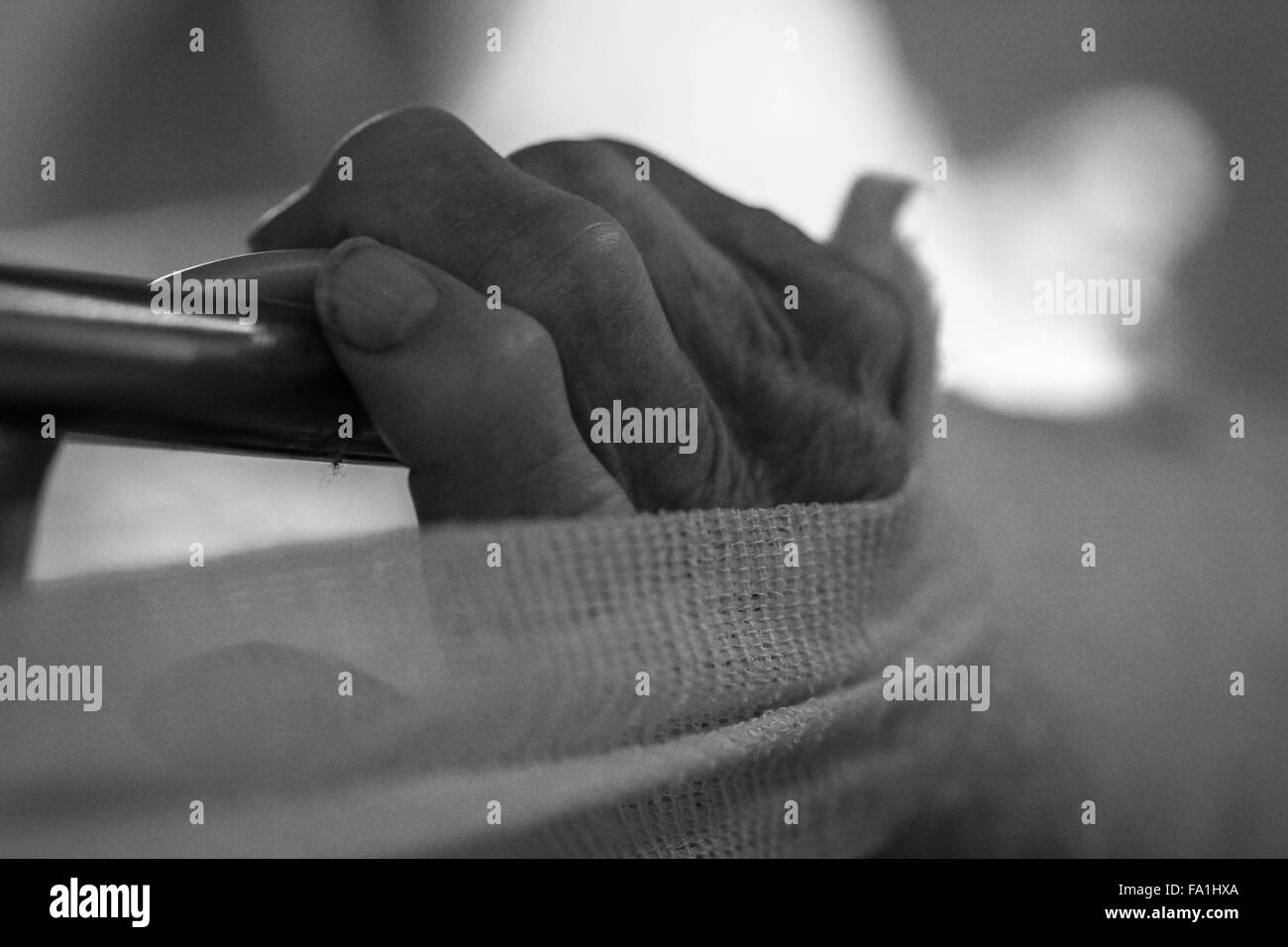 Old woman during surgery Stock Photo - Alamy