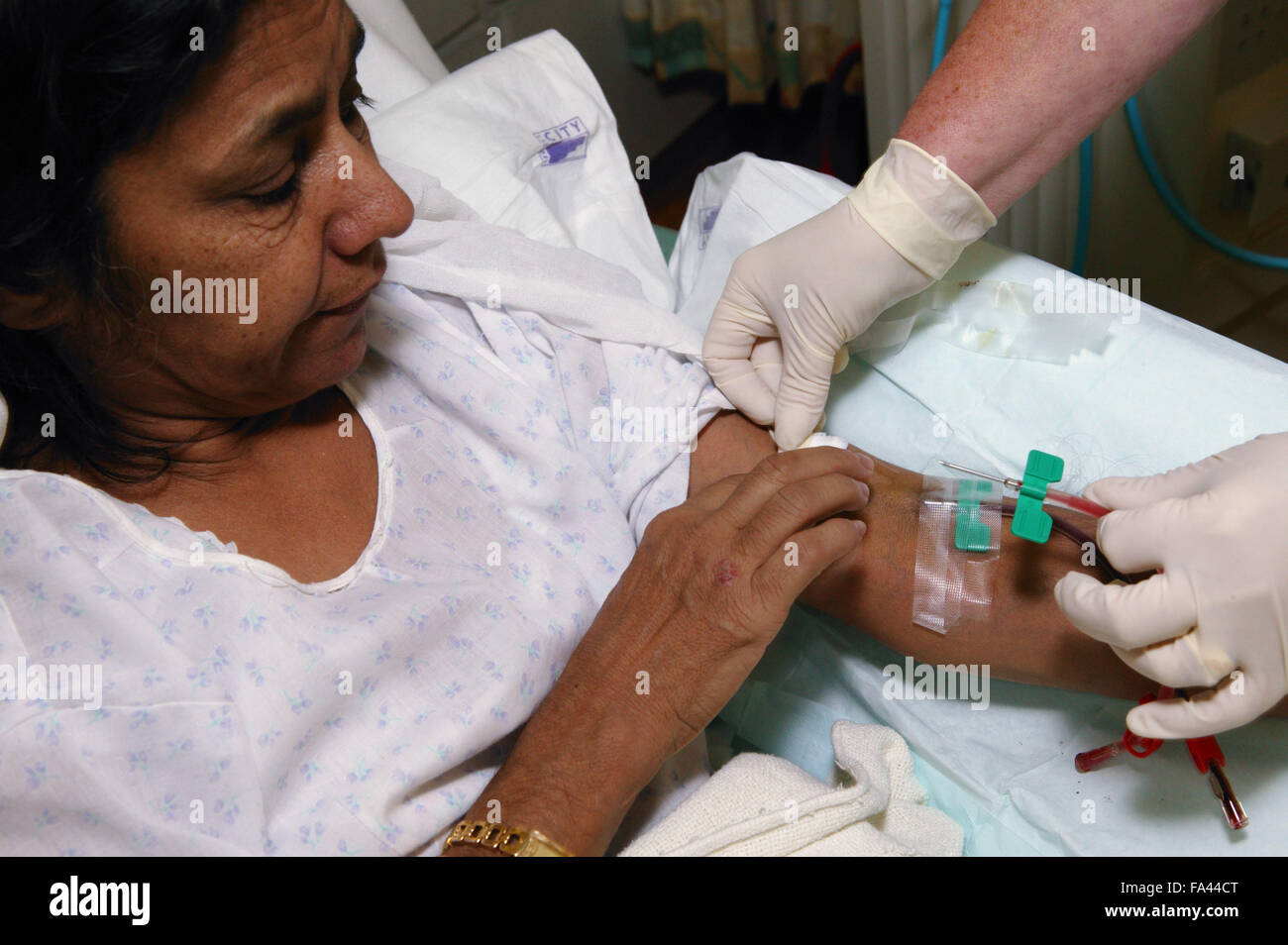 Support Nurse taking out line from Dialysis patients arm Stock Photo ...