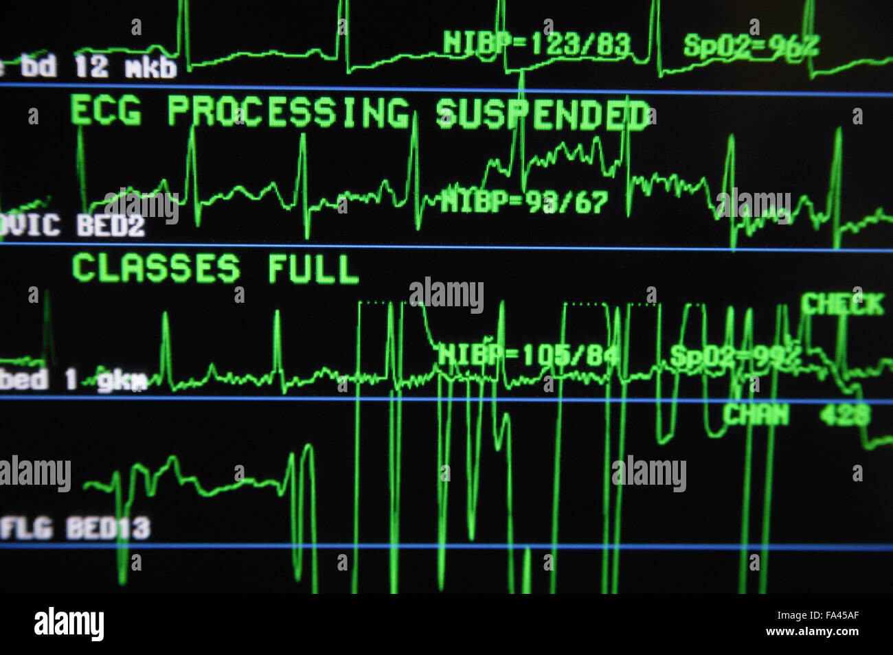 Close up of central monitoring screen at the nurses station on the ...