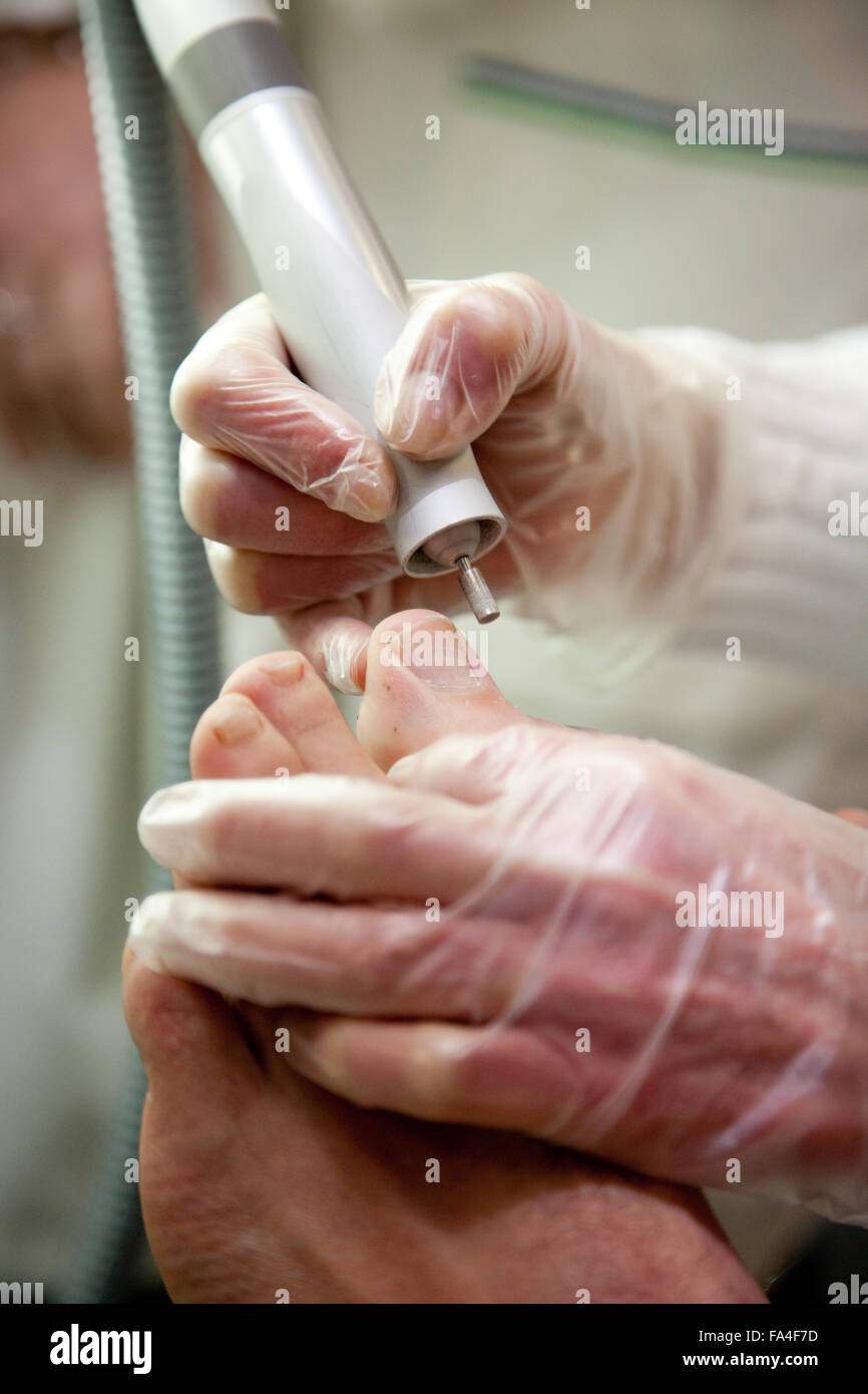 Chiropodist during the chiropody Stock Photo - Alamy