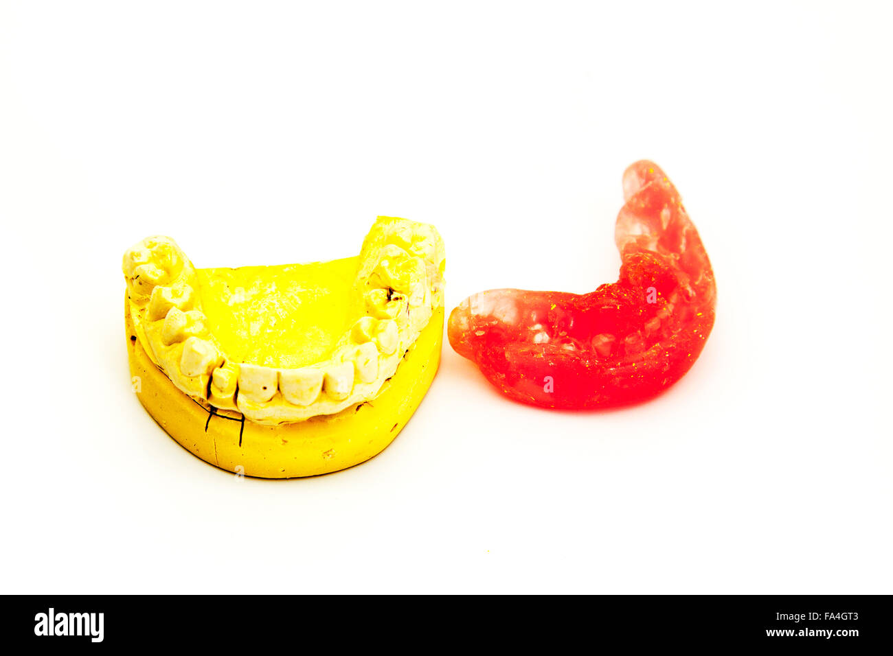 Teeth mould hi-res stock photography and images - Alamy