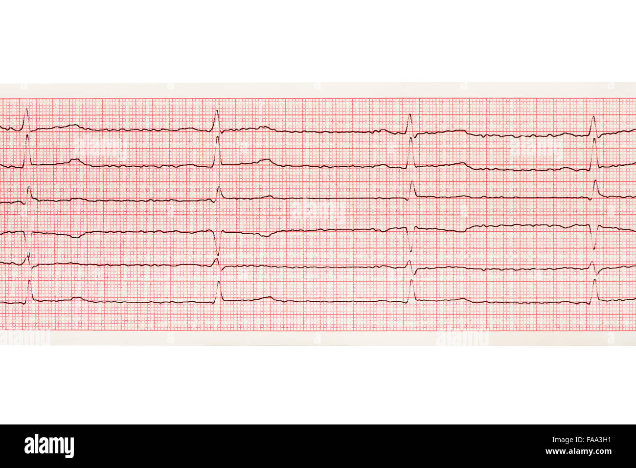 Paper ECG results isolated on white background. Clipping path included ...
