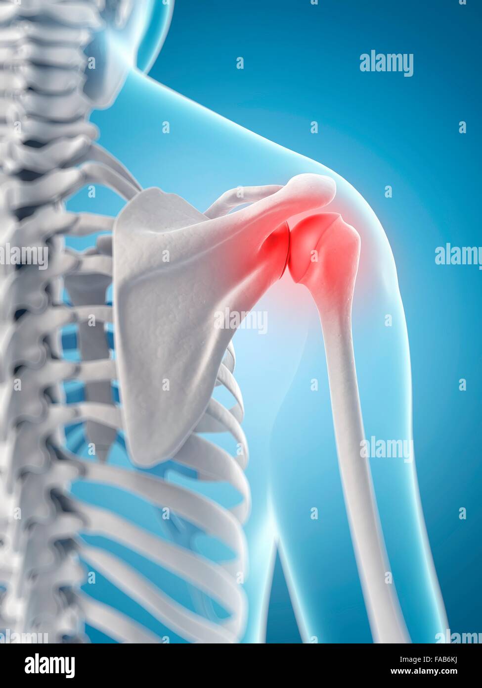 Human shoulder pain, computer illustration Stock Photo - Alamy