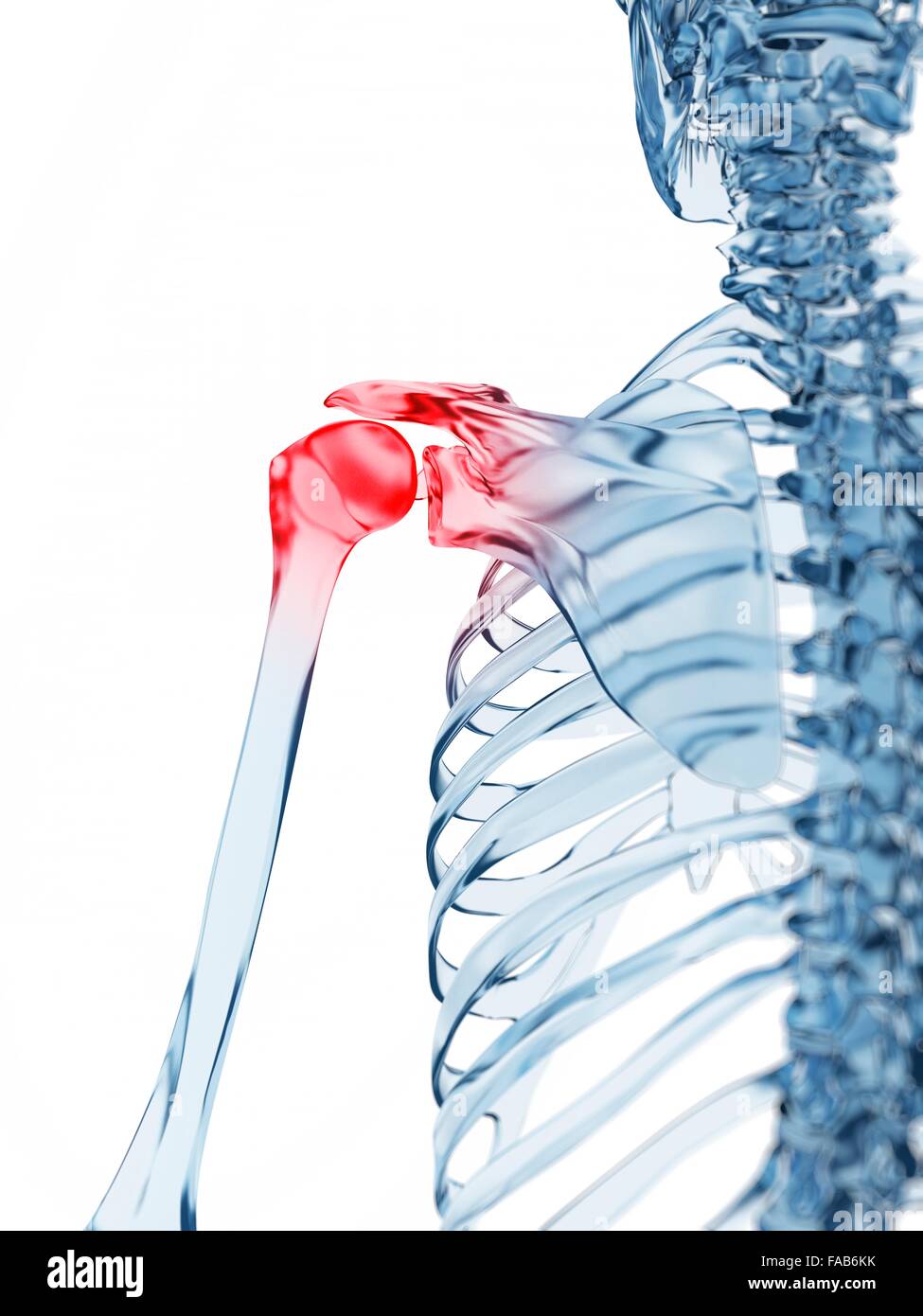 Human shoulder pain, computer illustration Stock Photo - Alamy