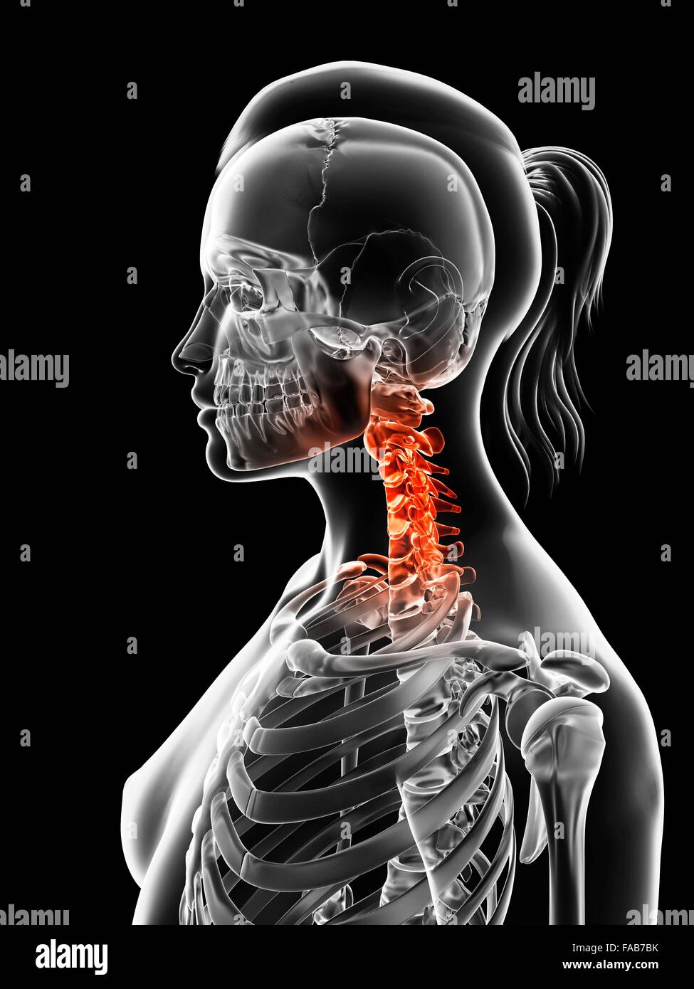 Human cervical spine pain, computer illustration Stock Photo - Alamy