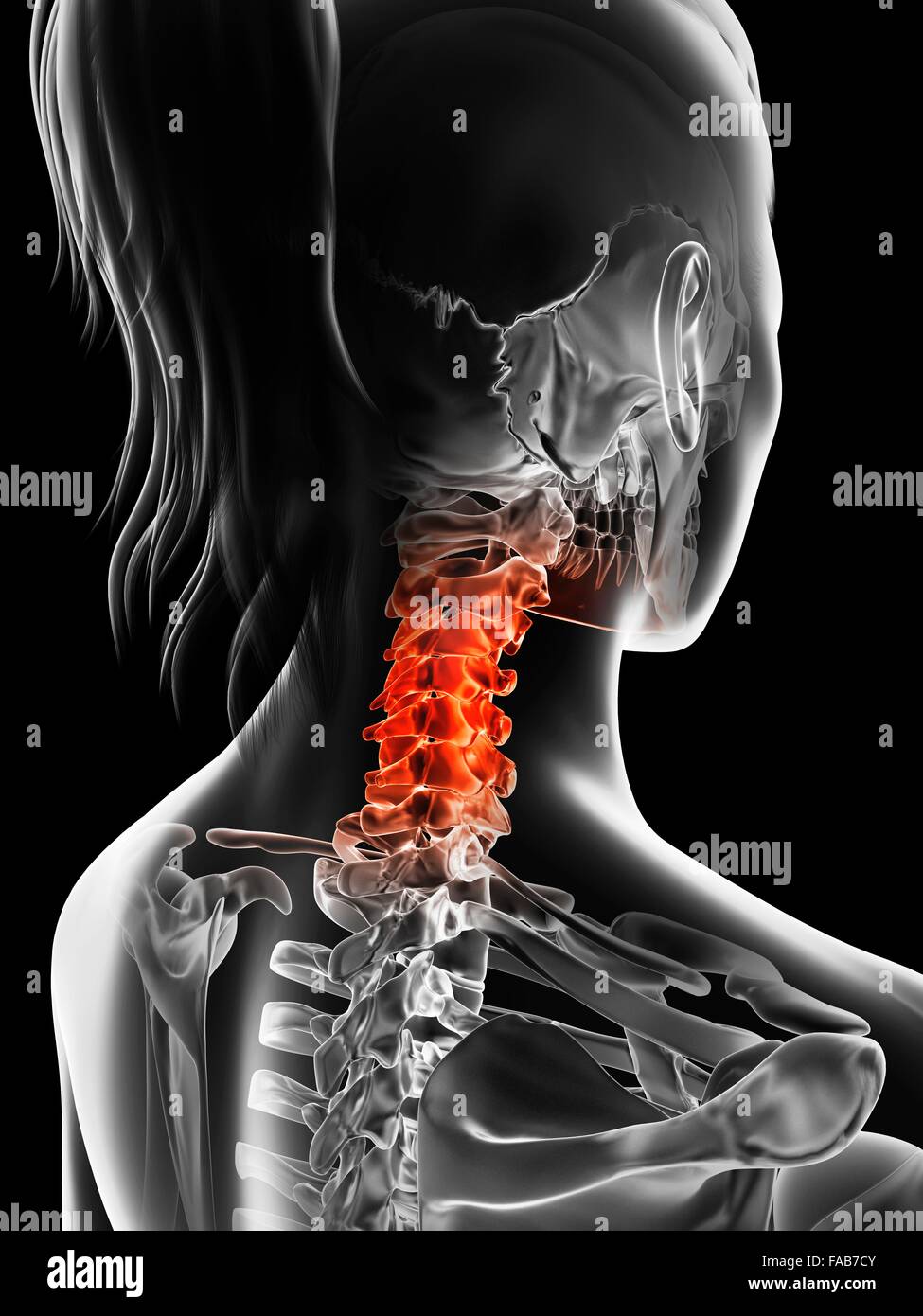 Human cervical spine pain, computer illustration Stock Photo - Alamy