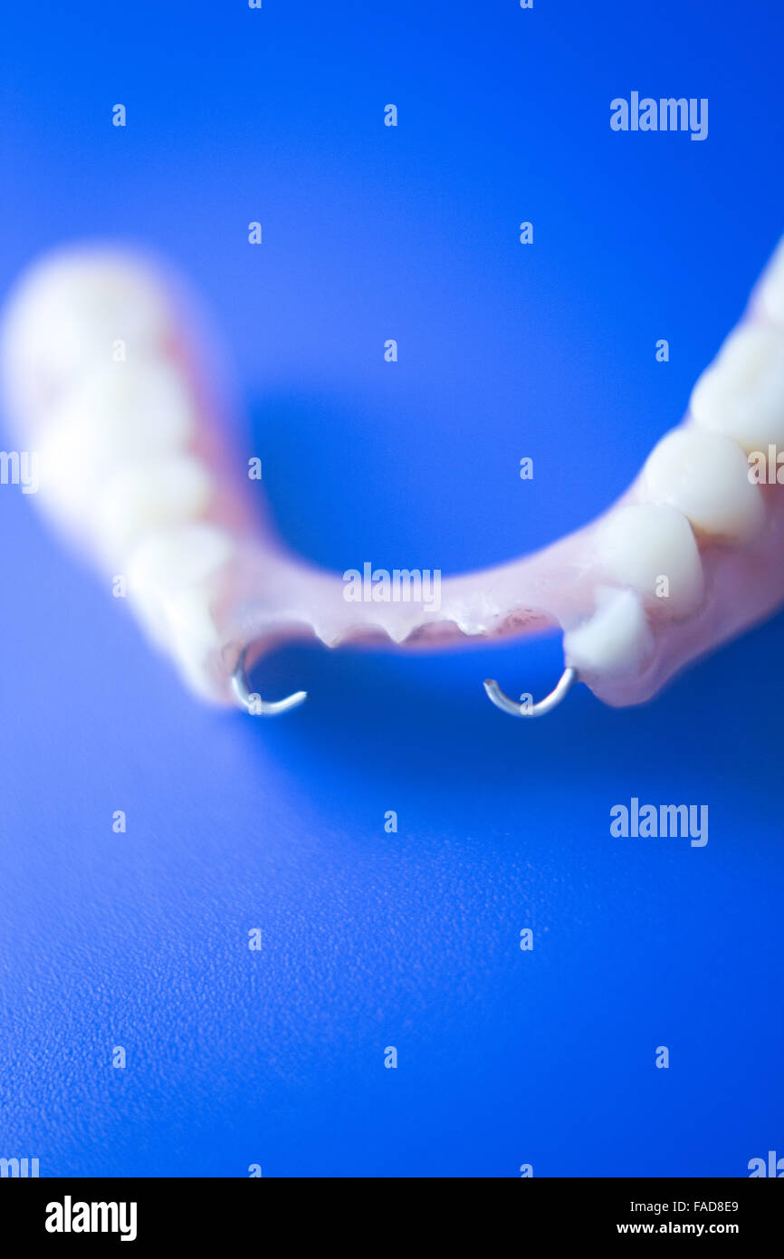 Removable partial denture metal and plastic dental false teeth ...