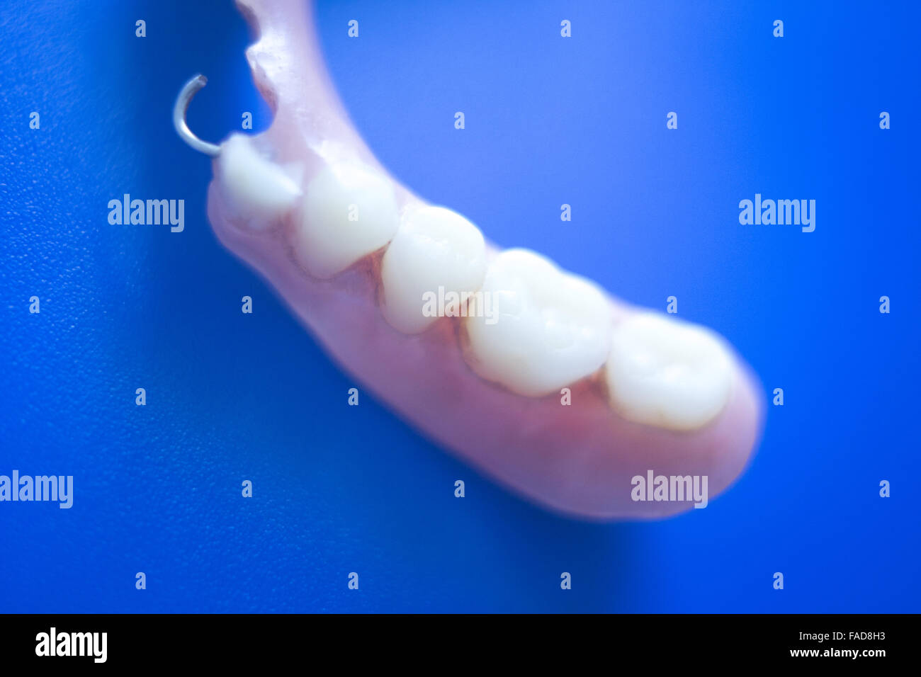 Removable partial denture metal and plastic dental false teeth ...