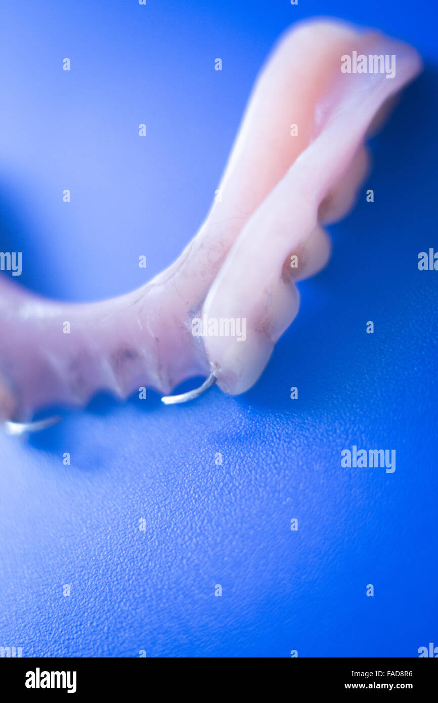 Removable partial denture metal and plastic dental false teeth ...