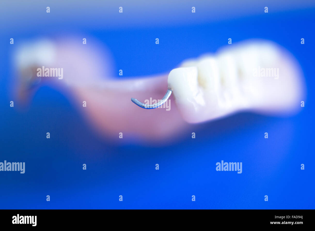 Removable partial denture metal and plastic dental false teeth ...